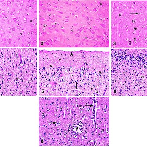 Photomicrographs Of Cerebral Cortex Sections Of Adult Male Mice In