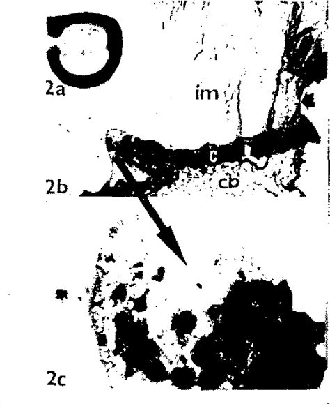 Figure 1 From Preparation Of Poly2 Hydroxyethyl Methacrylate Collagen