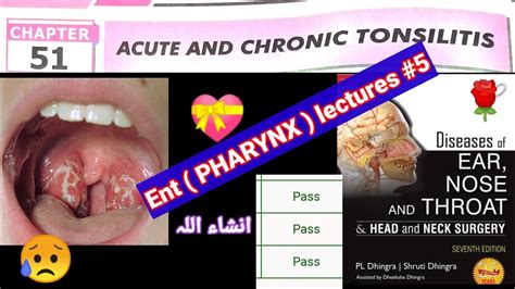 🔴🔴 Acute And Chronic Tonsillitis Lectures 5 Ent Pharynx Blood