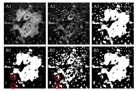 Automated Drusen Detection In Dry Age Related Macular Degeneration By Multiple Depth En Face