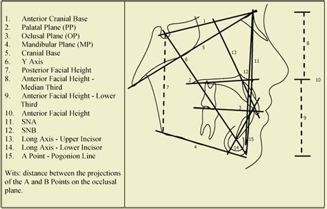 Proposed Cephalometric Analysis Download Scientific Diagram