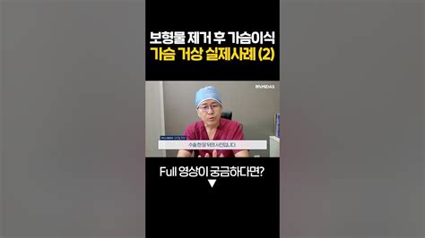 줄기세포지방이식 보형물 제거 후 가슴 거상 가슴이식 2편 Youtube
