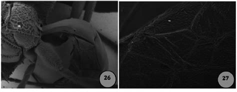 27 26 —scanning Electron Micrograph Of Meteorus Luteus New Species Download Scientific