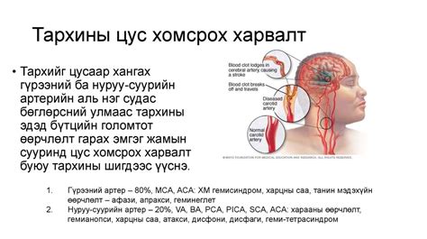 Тархины цочмог харвалт Online Presentation