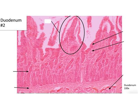 Duodenum 2 Histology Quiz