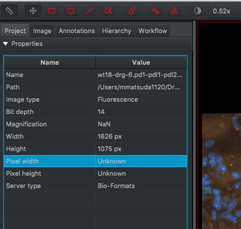 Automatic Quantification Issue Issue Qupath Qupath GitHub