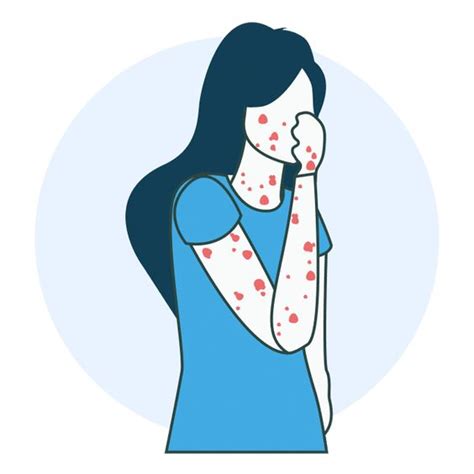 Tophealthanswers Skin Rash Types Symptoms Causes Diagnosis And