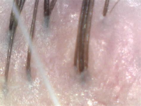 What Colour Is Your Scalp Yokos Haute Coiffure