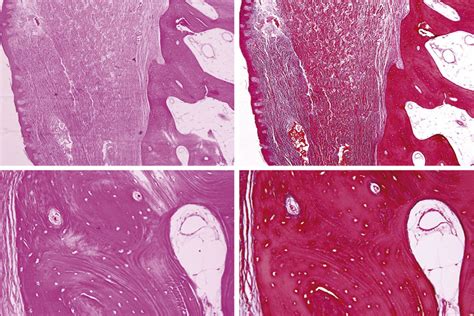 Mature Ho Histopathology The Figure Displays Stained Tissue Sections