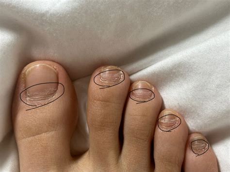 발톱에 무슨 문제가 있는 걸까요 지식in