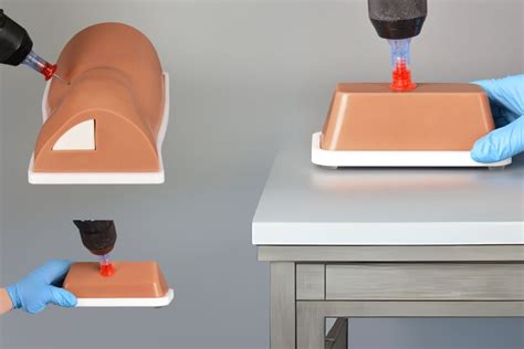 Preferred Sites For Intraosseous Access Injection Needle Insertion Ultrassist