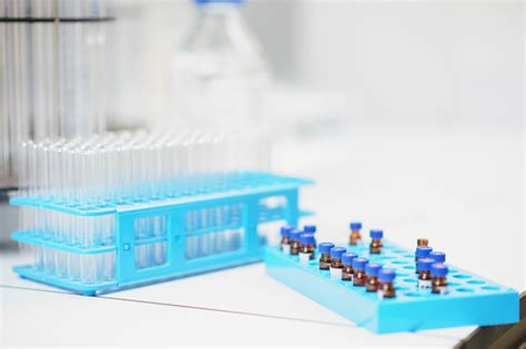 유리 실험실 튜브 튜브 및 샘플을 수집 하 고 특별 한 플라스틱 선반에 근접 촬영 테스트를 위한 테스트 튜브 Stem 주제에