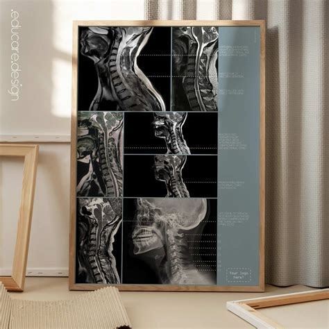 Cervical Pathology Artwork Educaredesign