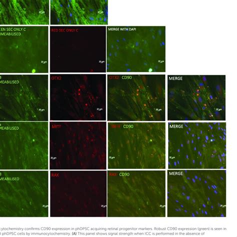 Schematic Diagram Of Classical Proteolytic Processing Of Amyloid