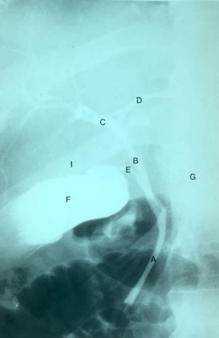 109 Cholangiogram 2 Diagram Quizlet