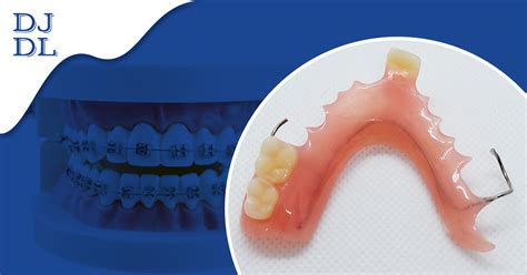 Flipper Tooth Replacement