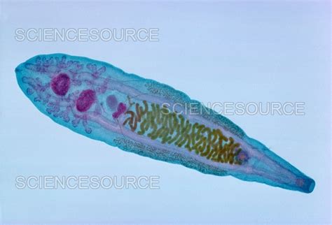 Opisthorchis Sinensis