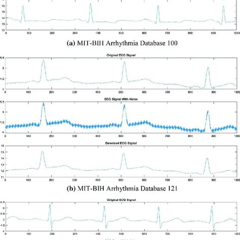 The Ecg Signal And Its Imfs Using Eemd Download Scientific Diagram