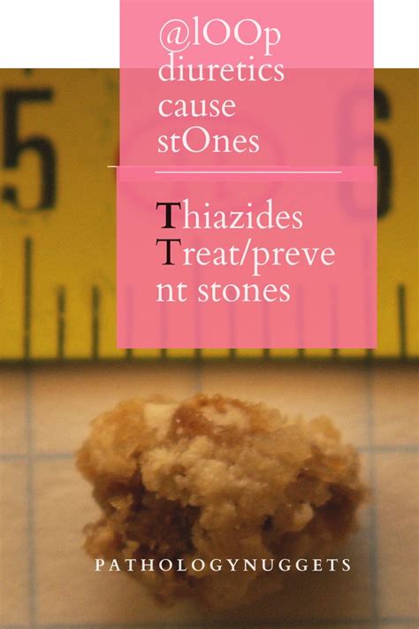 Difference Between Loop And Thiazide Diuretics In Calcium Metabolism Medical Mnemonic Calcium
