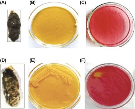 Stool Pcr Vs Stool Culture At Anglea Ramos Blog