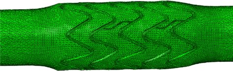 section of volume mesh used in the computational fluid dynamics cfd