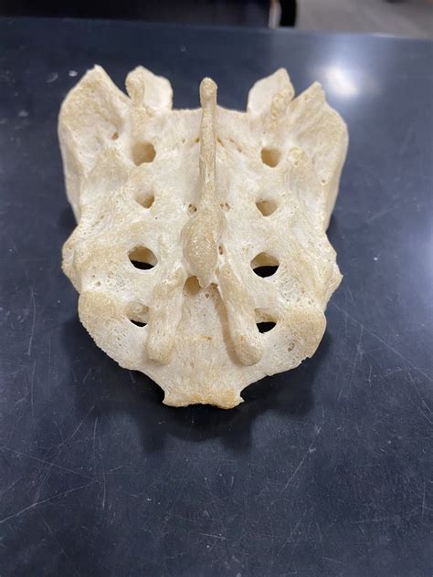 Sacral Bone Diagram Quizlet