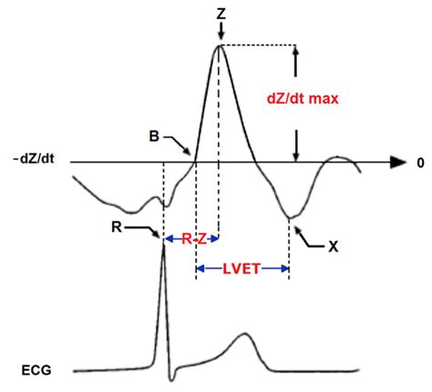 Issue With Dzdt Calculation For Impedance Cardiography Icg Waveform Using Max30009 Ev Kit Q