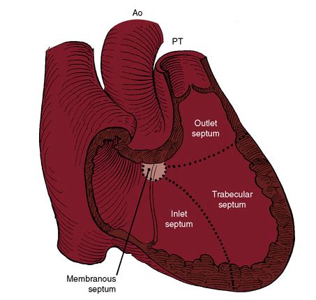 Interventricular Septum Parts