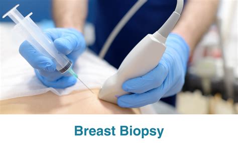 What Is A Breast Biopsy Apollo Hospitals Blog