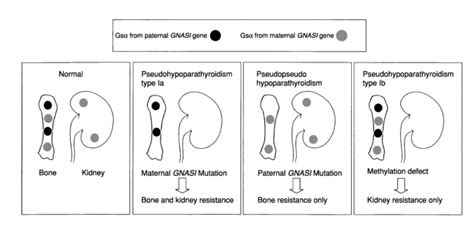 What Is Albrights Hereditary Osteodystrophy My Endo Consult