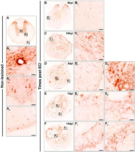 Spatio Temporal Protein Expression Pattern Of Frizzled 10 In The