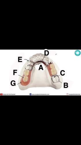 Part Of A Partial Denture Flashcards Quizlet