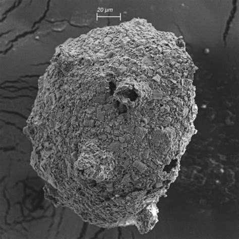 Difflugia Glans · Inaturalist