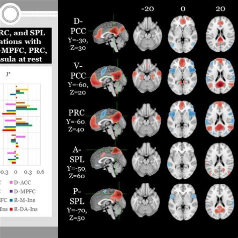 Title Resting State Functional Connectivity Analysis Examining D Pcc