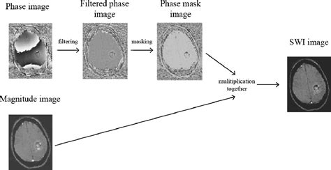 Figure 4 From The Visualization Of The Subthalamic Nucleus With