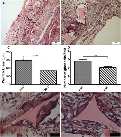 Histological Characteristics Of Implant Fibrous Capsule Representative Download Scientific