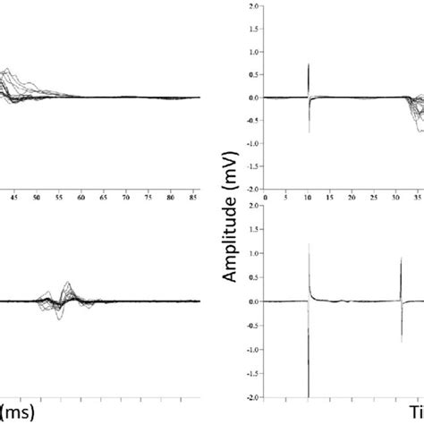 Overdrawing Of Meps Elicited By Single Pulse Stimulation Top And