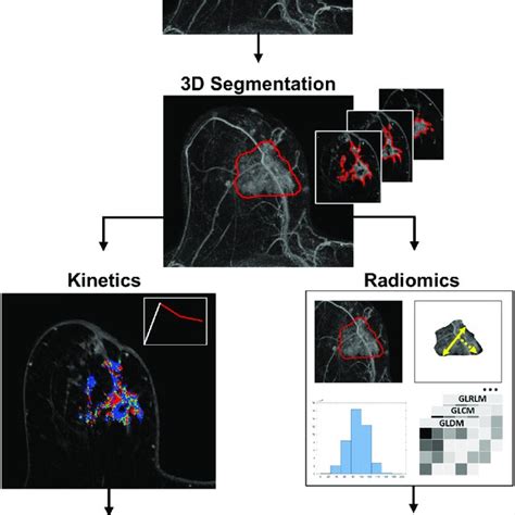 Postprocessing Pipeline For Quantitative Dce Mri Lesion Assessment Download Scientific Diagram