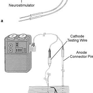 A Implantable Pulse Generator B Leads And Test Stimulator For Download Scientific Diagram