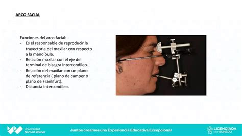 Arco Facial Implantología Pptx