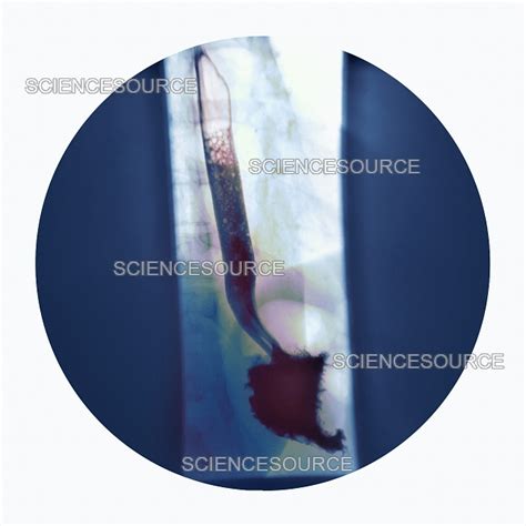 Normal Esophagus And Stomach X Ray Stock Image Science Source Images