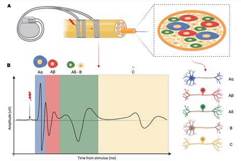 Figure 1 From Closed Loop Vagus Nerve Stimulation For The Treatment Of Cardiovascular Diseases