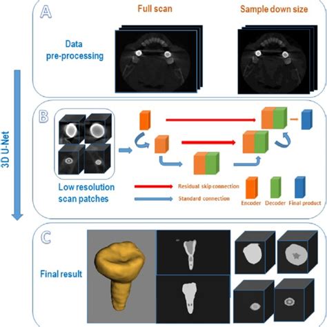 Workflow Of 3d U Net Based Segmentation Model A Data Pre Processing To