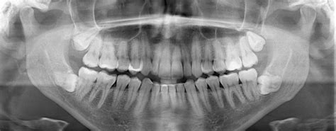 Ortopantomografia Studio Dentistico Uzzielli