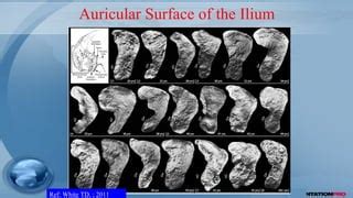 Auricular Surface Age