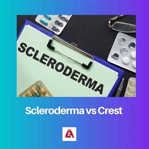 Scleroderma Vs Crest Difference And Comparison Scleroderma Vs Crest Difference And Comparison