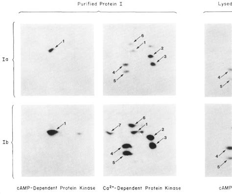 Figure From Differential Phosphorylation Of Multiple Sites In Purified Protein I By Cyclic