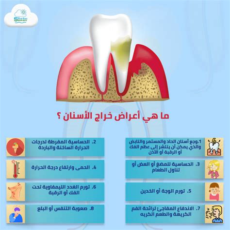 انفوجرافيك ما هي أعراض خراج الأسنان؟ 2025 صحةسكاي