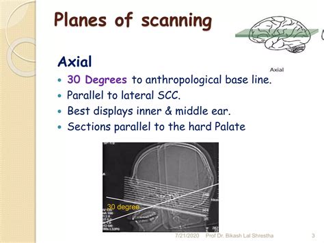 How To Read Ct Scan Temporal Bone A Dhulikhel Hospital Kathmandu University Hospital Protocol