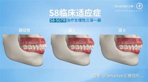 正雅答疑丨s8 Sgtb与s8 Sghb的共同点和区别是什么？ 知乎